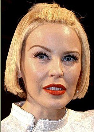 打腫臉症候群 (facial overfilled syndrome) - 吉祥醫生 Dr. Kut Cheung's Blog